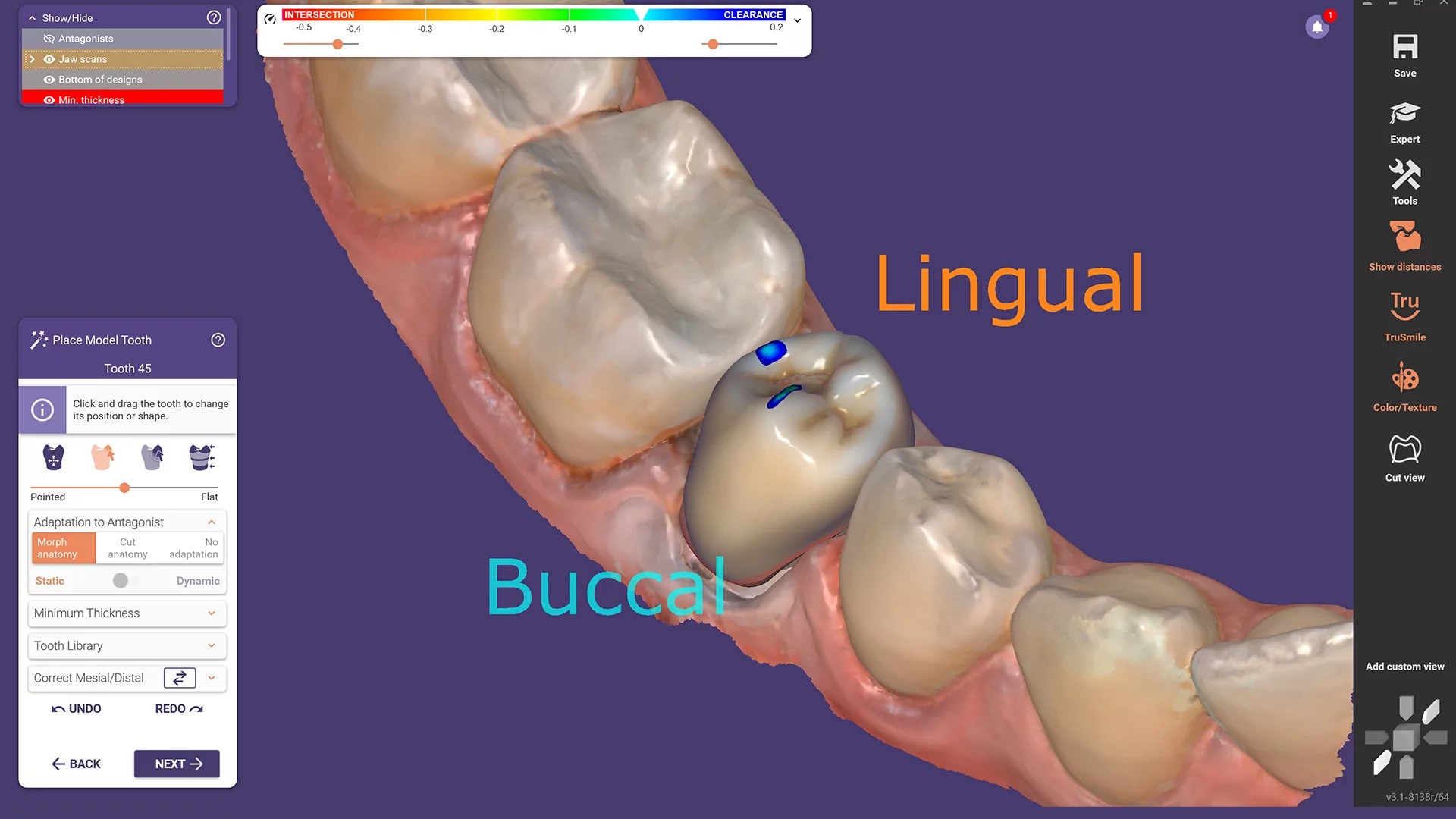 exocad - Powerful CAD solution for dental labs -Authorized Reseller