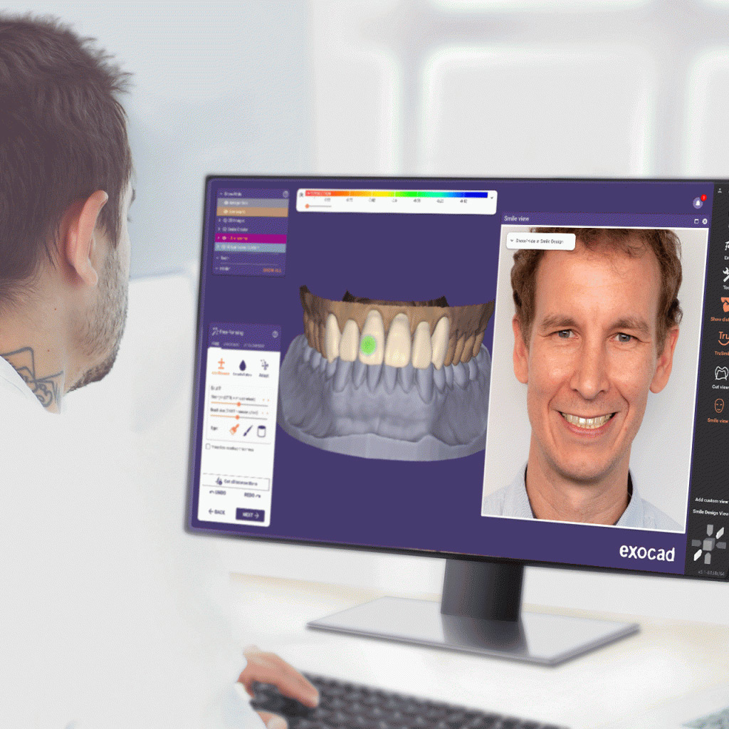 Digital Dental Equipment - CAD/CAM